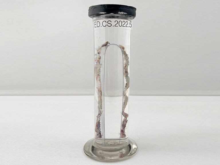 Resource for patients with pelvic mesh - Patient Safety Commissioner